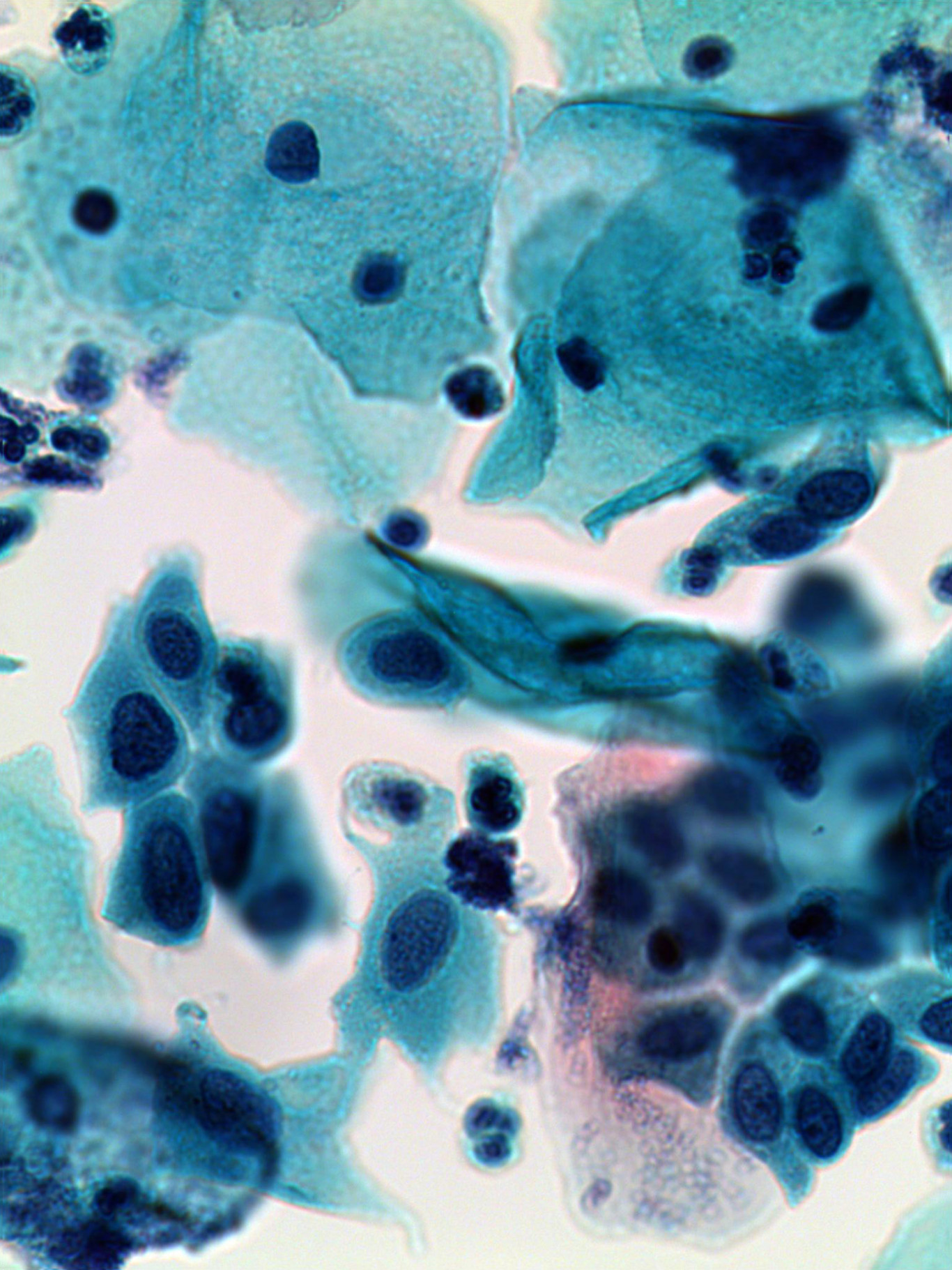 Patient Locations » Incyte Diagnostics